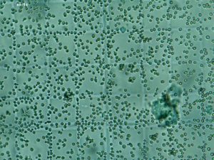 Saccharomyces Boulardii: The Top 10 Benefits of this Probiotic Yeast